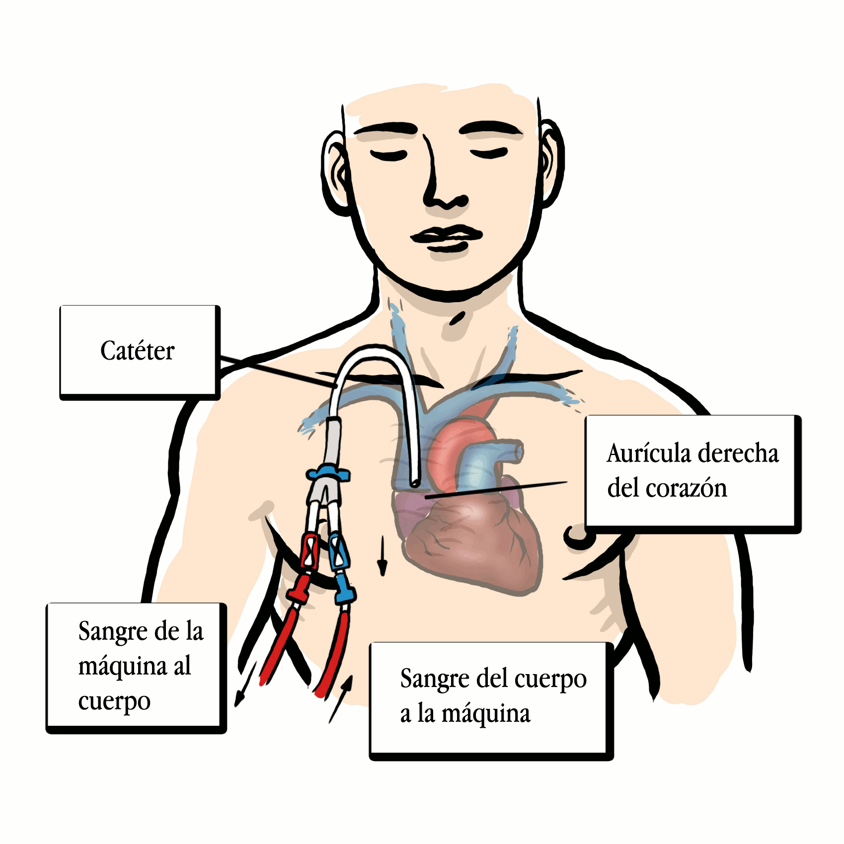 Infermeravirtual Enfermedad Renal Crónica Problemas De Salud
